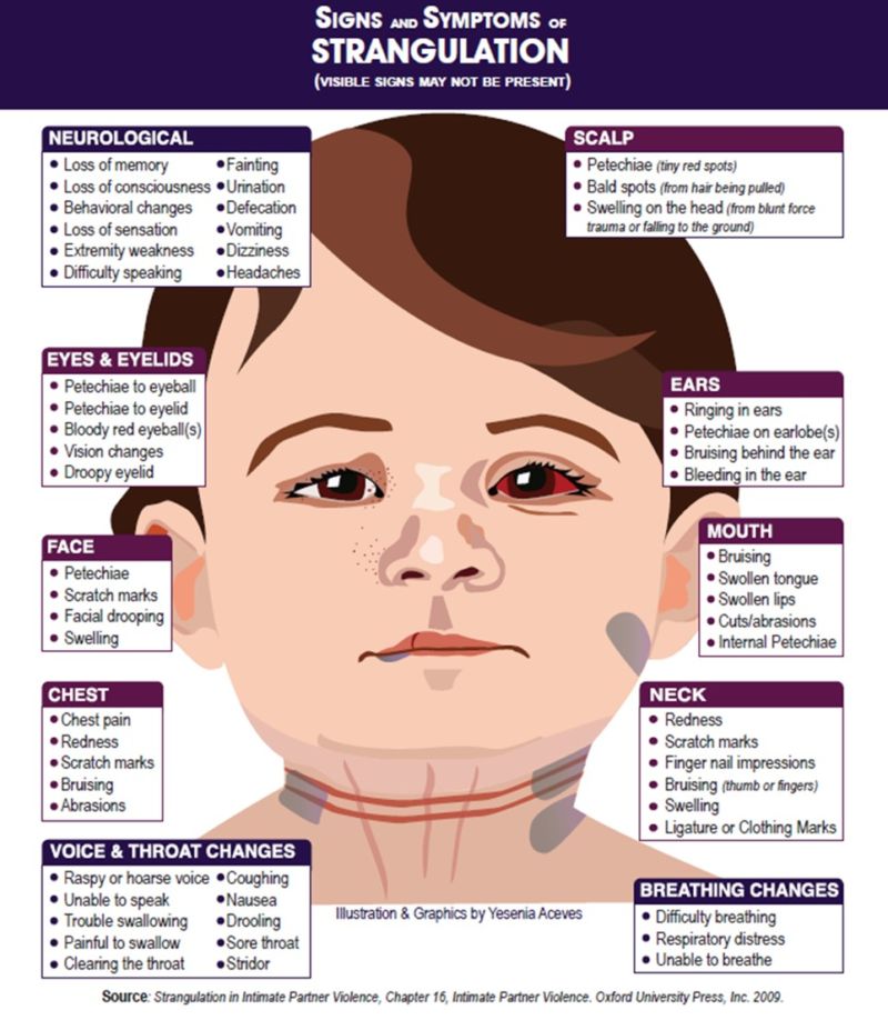 Australian institute for Strangulation Prevention